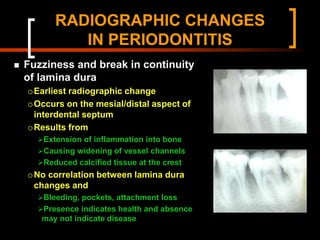 radiographic aids in the diagnosis of periodontal disease.ppt