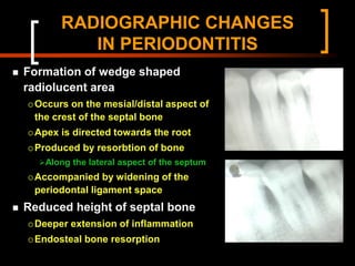 radiographic aids in the diagnosis of periodontal disease.ppt