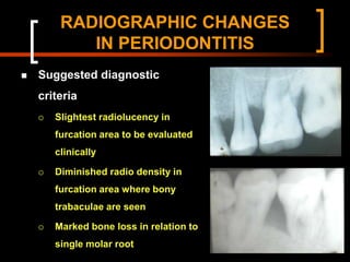radiographic aids in the diagnosis of periodontal disease.ppt