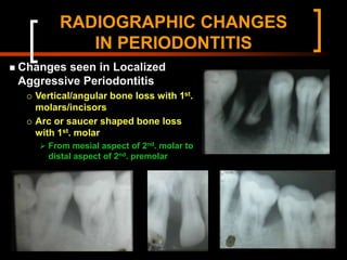 radiographic aids in the diagnosis of periodontal disease.ppt