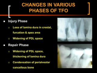 radiographic aids in the diagnosis of periodontal disease.ppt