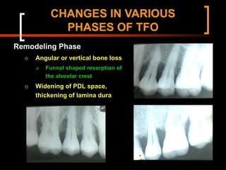radiographic aids in the diagnosis of periodontal disease.ppt