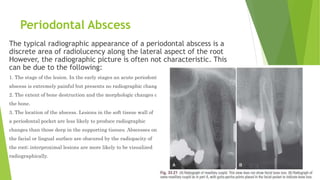 Radiographic Aids in the Diagnosis of Periodontal Diseases.pptx