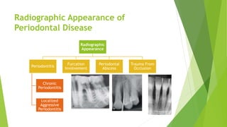 Radiographic Aids in the Diagnosis of Periodontal Diseases.pptx