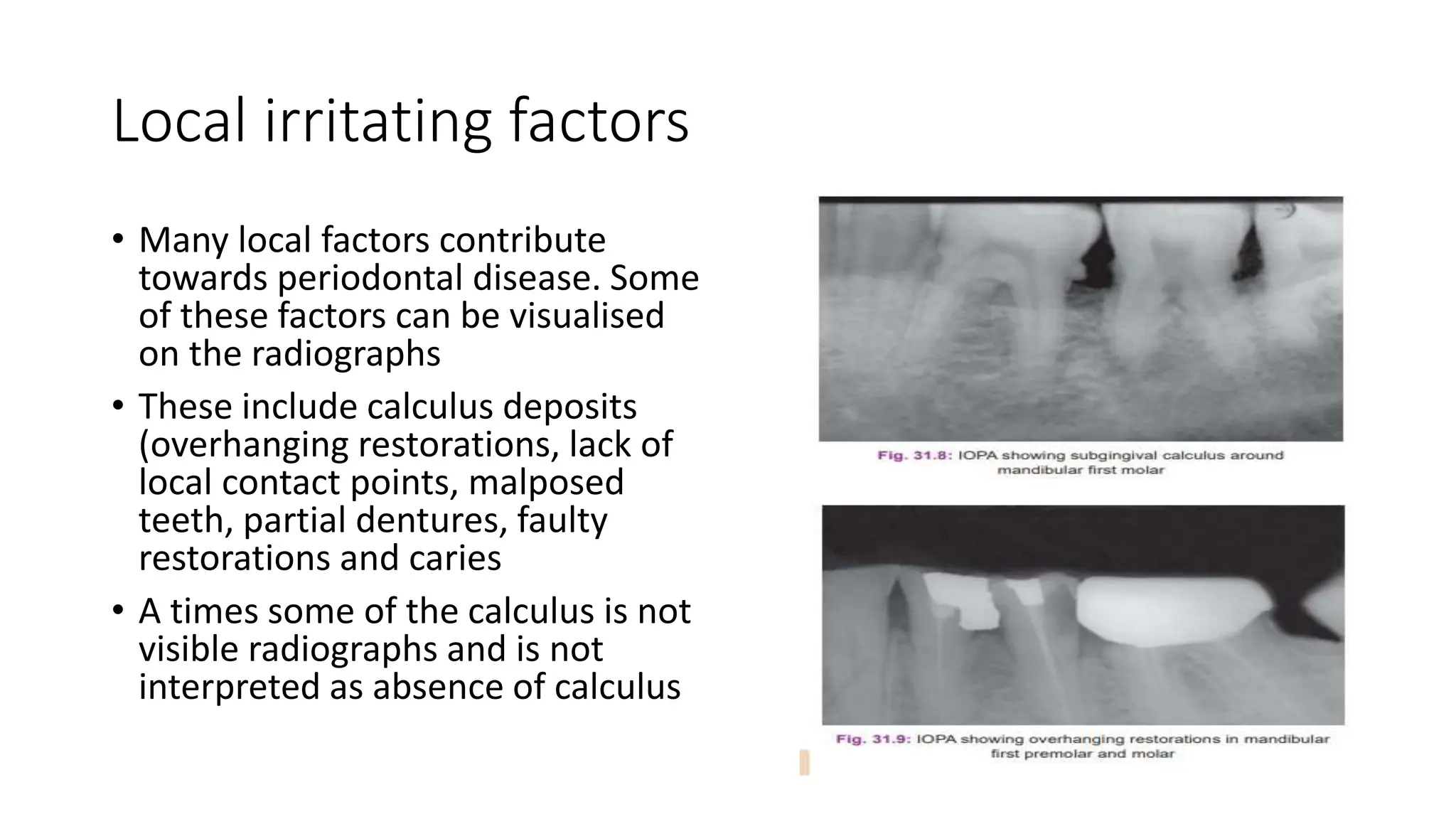 RADIOGRAPHIC AIDS IN THE DIAGNOSIS OF PERIODONTAL DISEASES.pptx