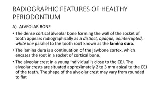 RADIOGRAPHIC AIDS IN THE DIAGNOSIS OF PERIODONTAL DISEASES.pptx