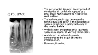RADIOGRAPHIC AIDS IN THE DIAGNOSIS OF PERIODONTAL DISEASES.pptx ...
