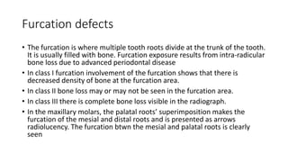 RADIOGRAPHIC AIDS IN THE DIAGNOSIS OF PERIODONTAL DISEASES.pptx ...