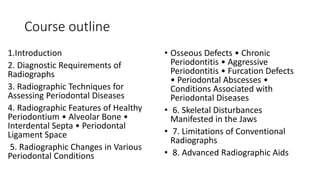 RADIOGRAPHIC AIDS IN THE DIAGNOSIS OF PERIODONTAL DISEASES.pptx ...