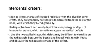 RADIOGRAPHIC AIDS IN THE DIAGNOSIS OF PERIODONTAL DISEASES.pptx ...