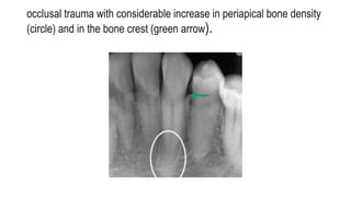 RADIOGRAPHIC AIDS IN THE DIAGNOSIS OF PERIODONTAL DISEASES.pptx ...