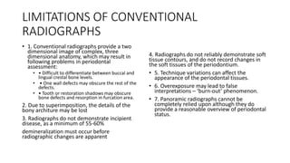 RADIOGRAPHIC AIDS IN THE DIAGNOSIS OF PERIODONTAL DISEASES.pptx