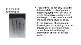 RADIOGRAPHIC AIDS IN THE DIAGNOSIS OF PERIODONTAL DISEASES.pptx ...