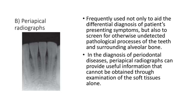 RADIOGRAPHIC AIDS IN THE DIAGNOSIS OF PERIODONTAL DISEASES.pptx ...