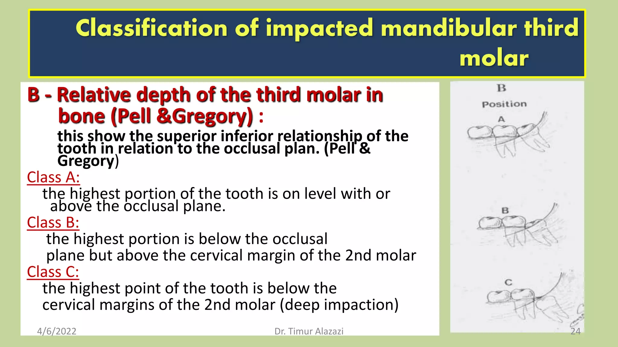 Radiographical assesment of impacted teeth | PPTX