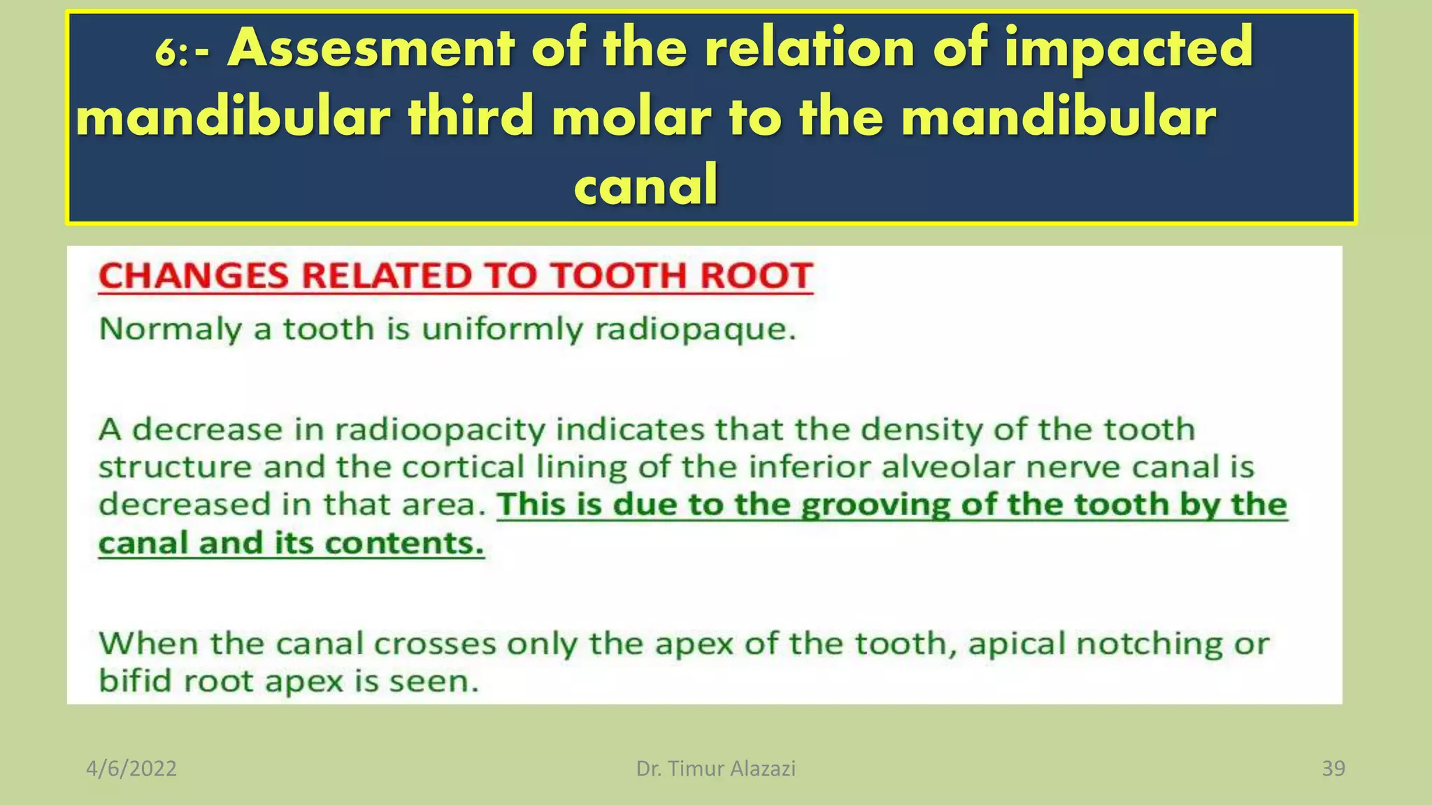 Radiographical assesment of impacted teeth | PPTX