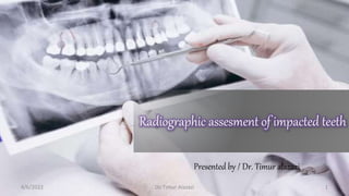 Radiographical assesment of impacted teeth | PPTX