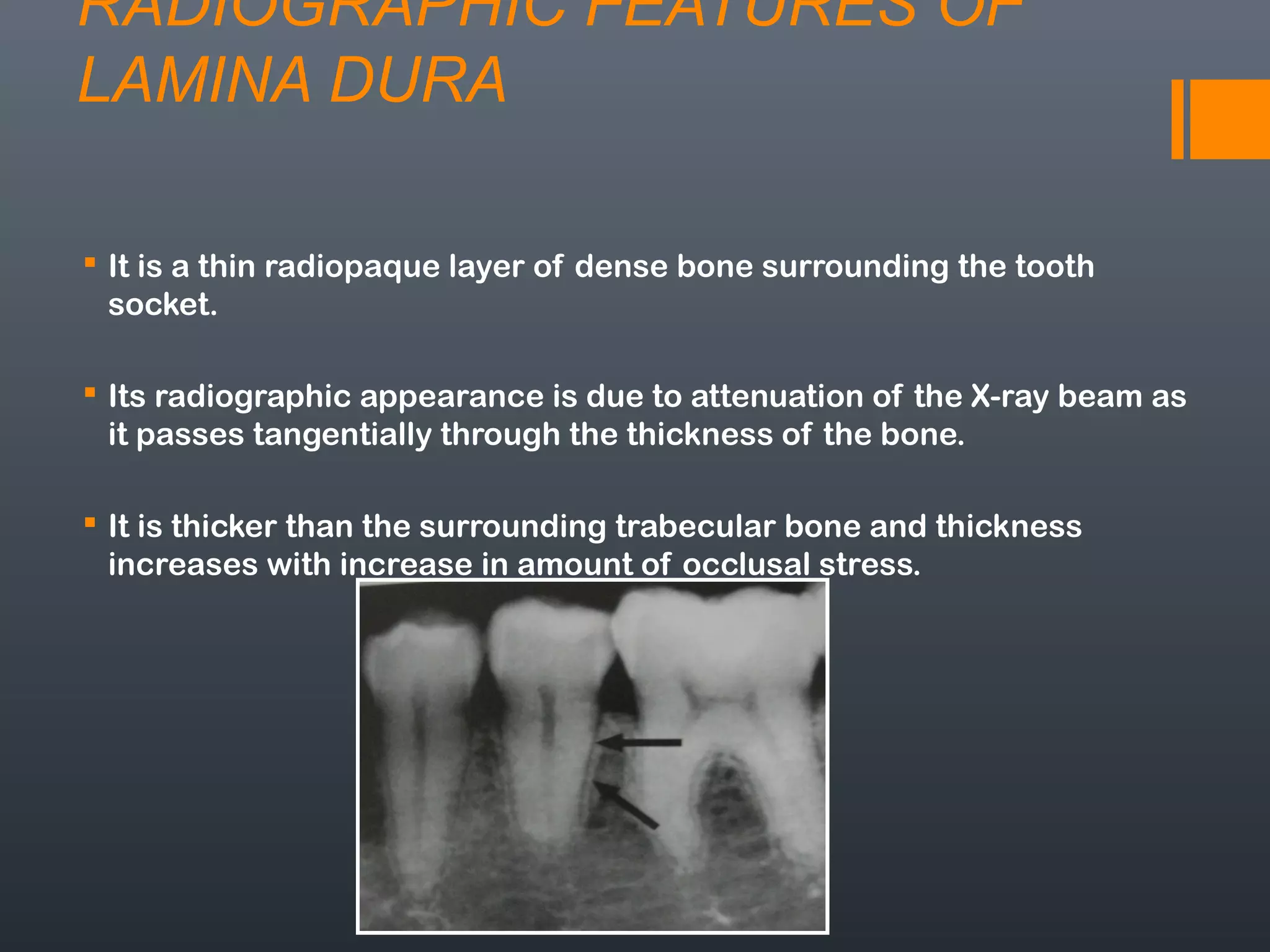 Radiographic anatomical landmarks By Dr. Armaan Singh | PPT