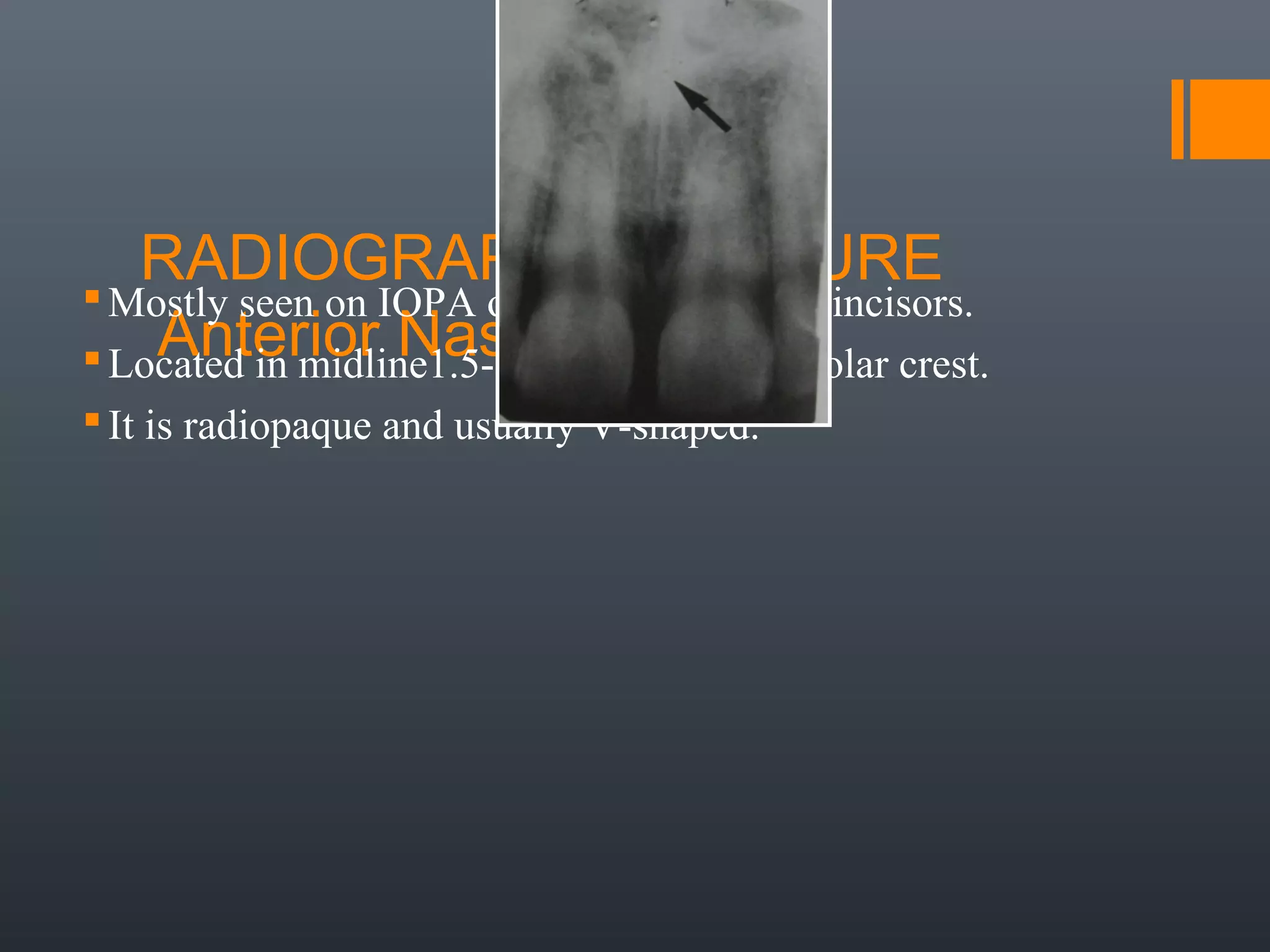 Radiographic anatomical landmarks By Dr. Armaan Singh | PPT
