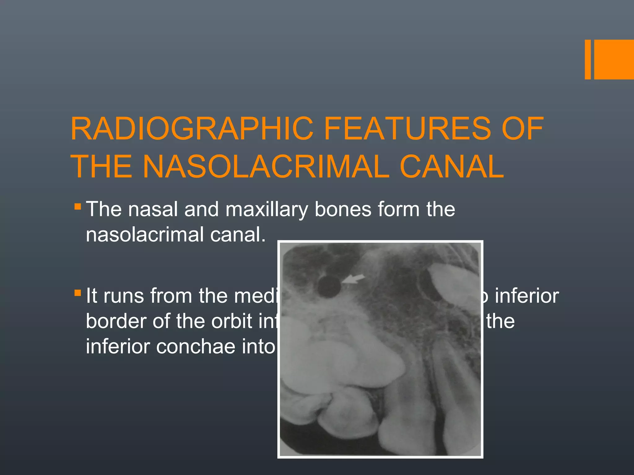 Radiographic anatomical landmarks By Dr. Armaan Singh | PPT