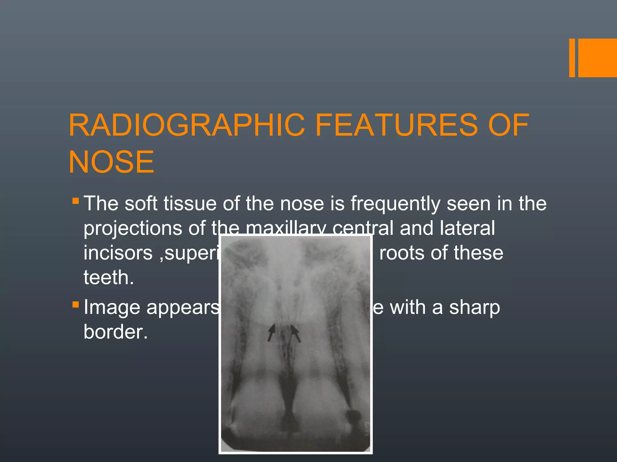 Radiographic anatomical landmarks By Dr. Armaan Singh | PPT