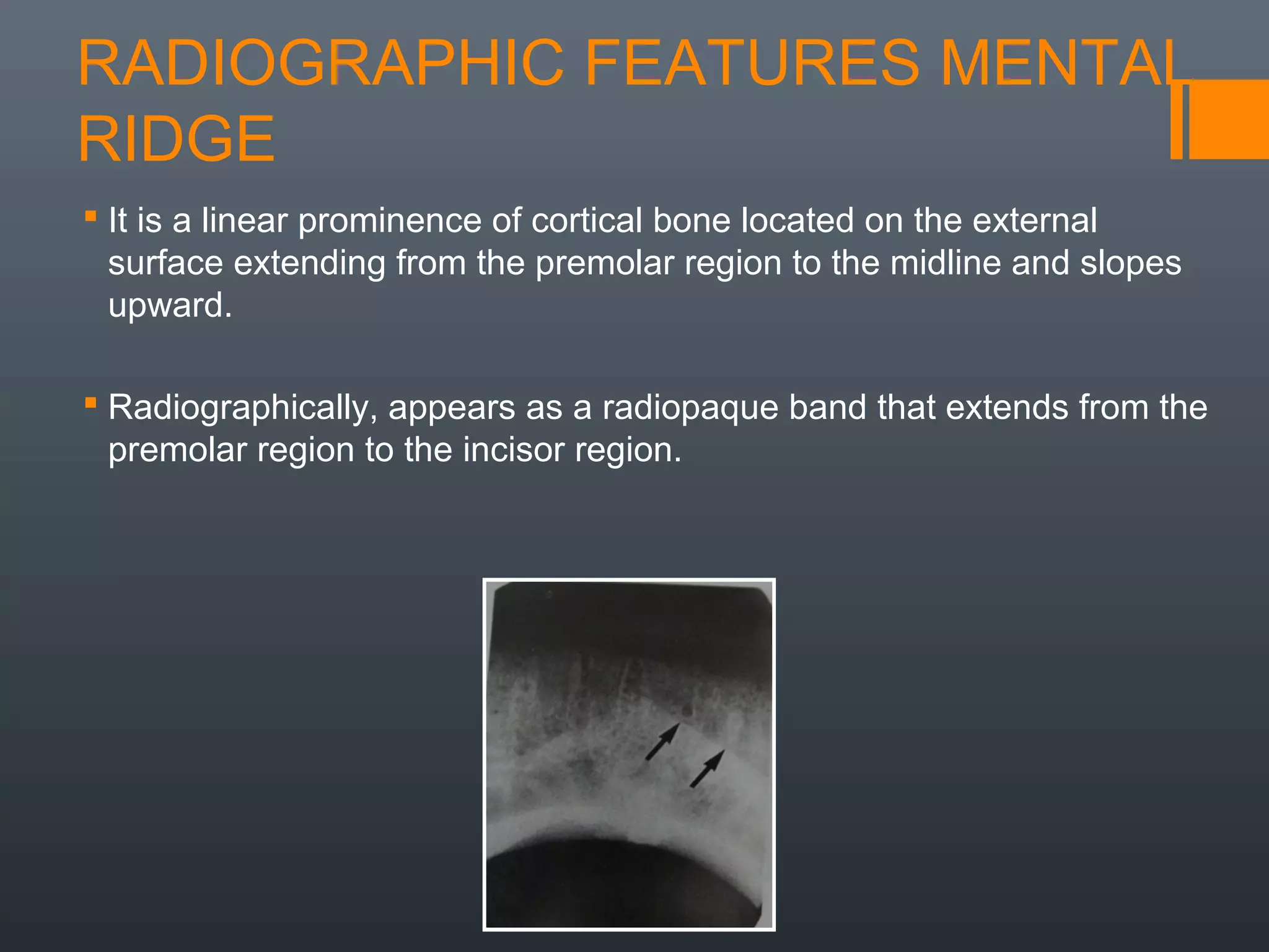 Radiographic anatomical landmarks By Dr. Armaan Singh | PPT