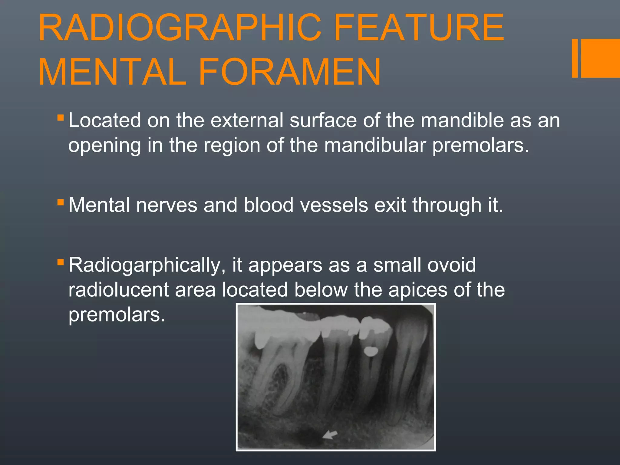 Radiographic anatomical landmarks By Dr. Armaan Singh | PPT