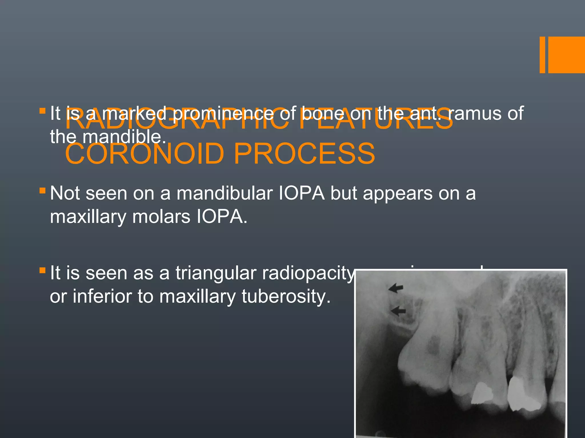Radiographic anatomical landmarks By Dr. Armaan Singh | PPT