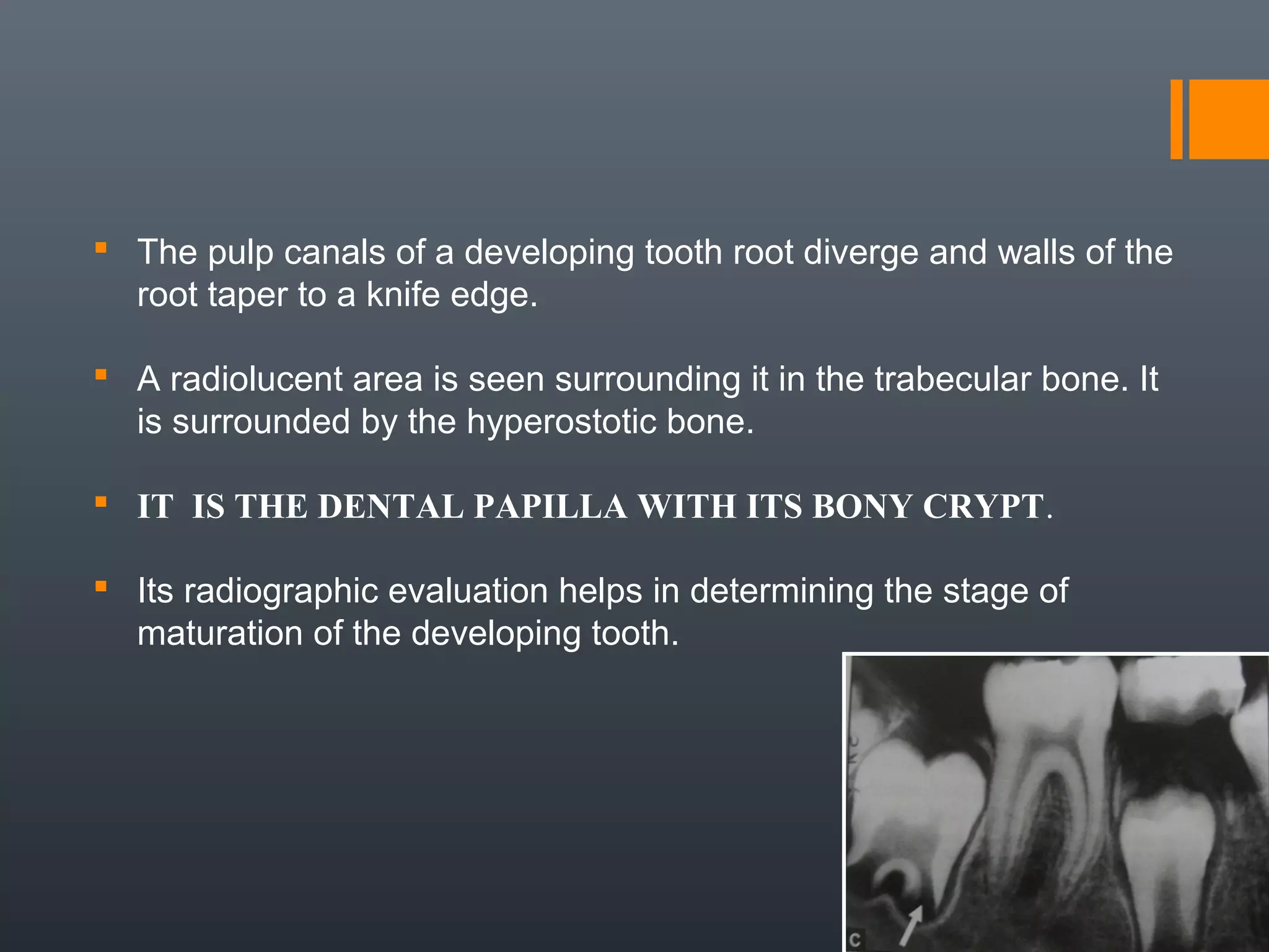 Radiographic anatomical landmarks By Dr. Armaan Singh | PPT
