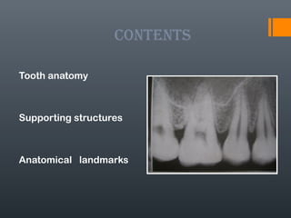 Radiographic anatomical landmarks By Dr. Armaan Singh | PPT
