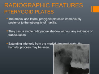 Pterygoid Plate Radiograph
