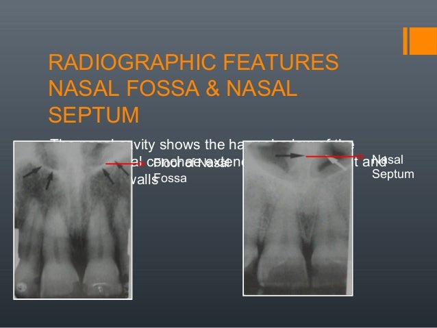 Radiographic anatomical landmarks By Dr. Armaan Singh