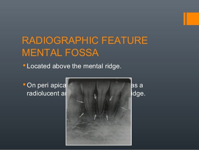 Mental Fossa Radiograph