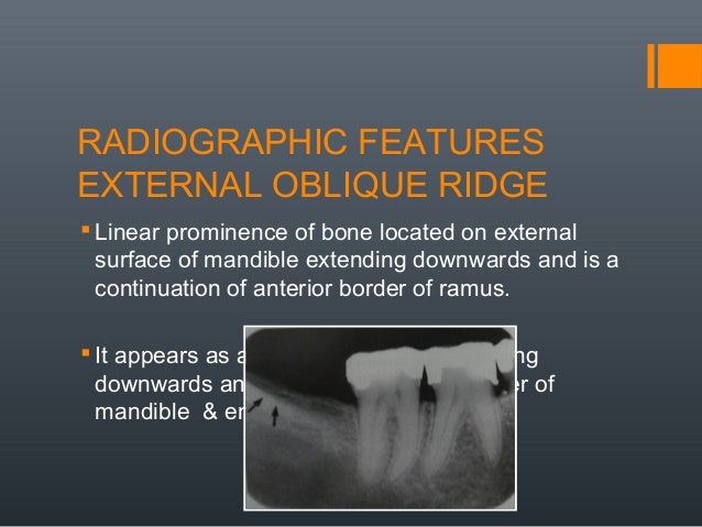 External Oblique Ridge