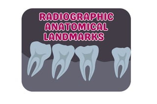 DENTAL RADIOGRAPHIC ANATOMICAL LANDMARKS .pdf