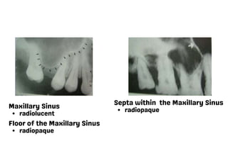 DENTAL RADIOGRAPHIC ANATOMICAL LANDMARKS .pdf