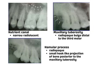 DENTAL RADIOGRAPHIC ANATOMICAL LANDMARKS .pdf