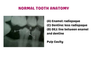 DENTAL RADIOGRAPHIC ANATOMICAL LANDMARKS .pdf