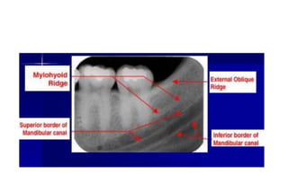 DENTAL RADIOGRAPHIC ANATOMICAL LANDMARKS .pdf