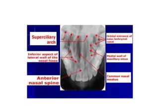DENTAL RADIOGRAPHIC ANATOMICAL LANDMARKS .pdf