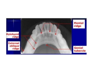 DENTAL RADIOGRAPHIC ANATOMICAL LANDMARKS .pdf