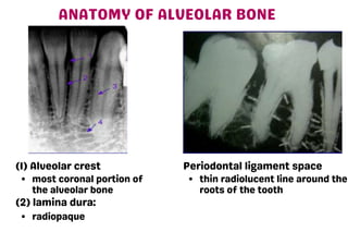 DENTAL RADIOGRAPHIC ANATOMICAL LANDMARKS .pdf