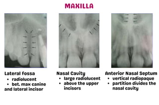 DENTAL RADIOGRAPHIC ANATOMICAL LANDMARKS .pdf