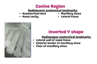 DENTAL RADIOGRAPHIC ANATOMICAL LANDMARKS .pdf