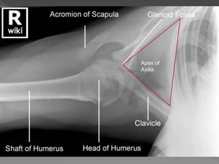 Radiographic anatomy of upper limb | PPTX