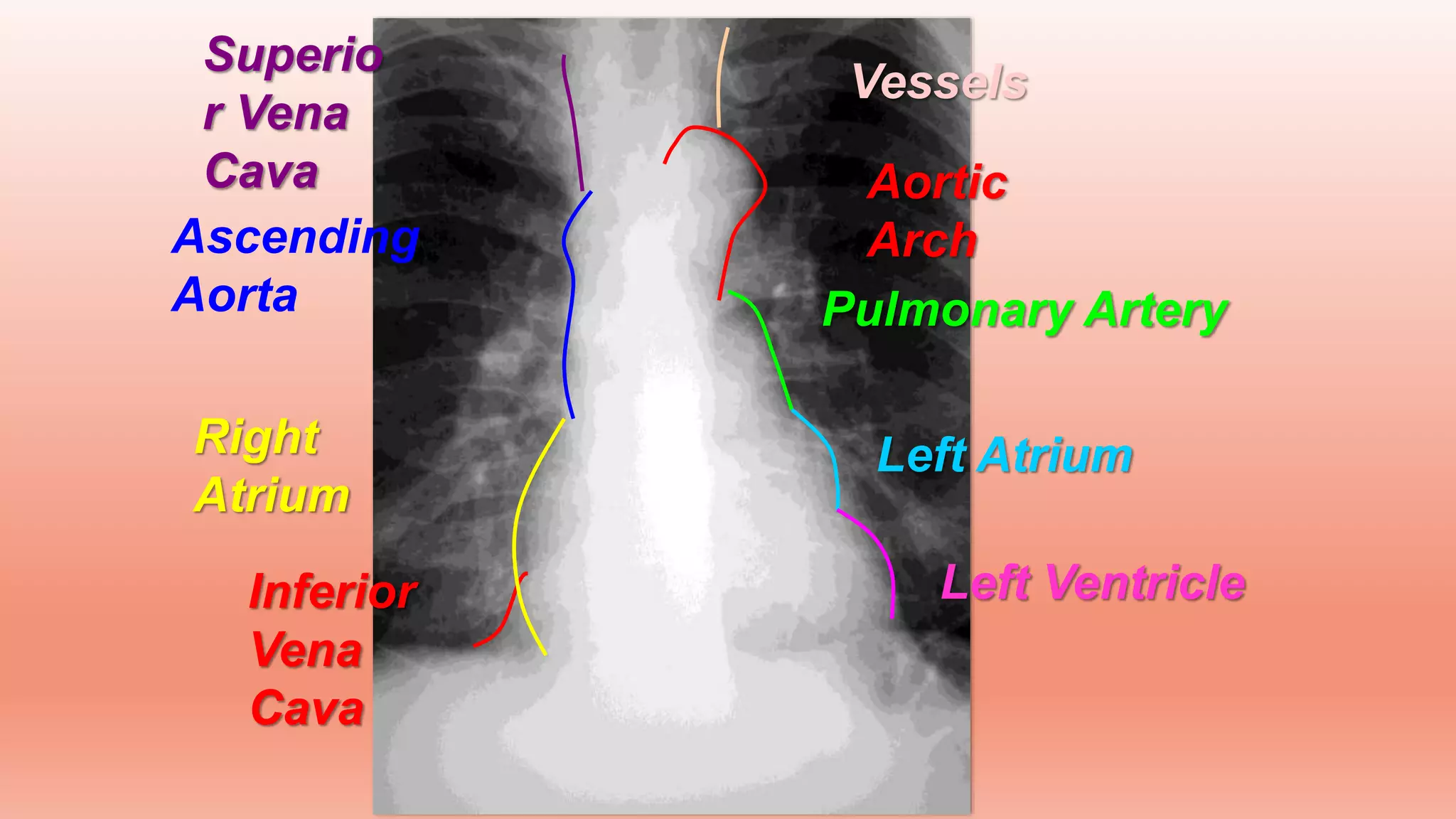 Radiographic anatomy | PPTX