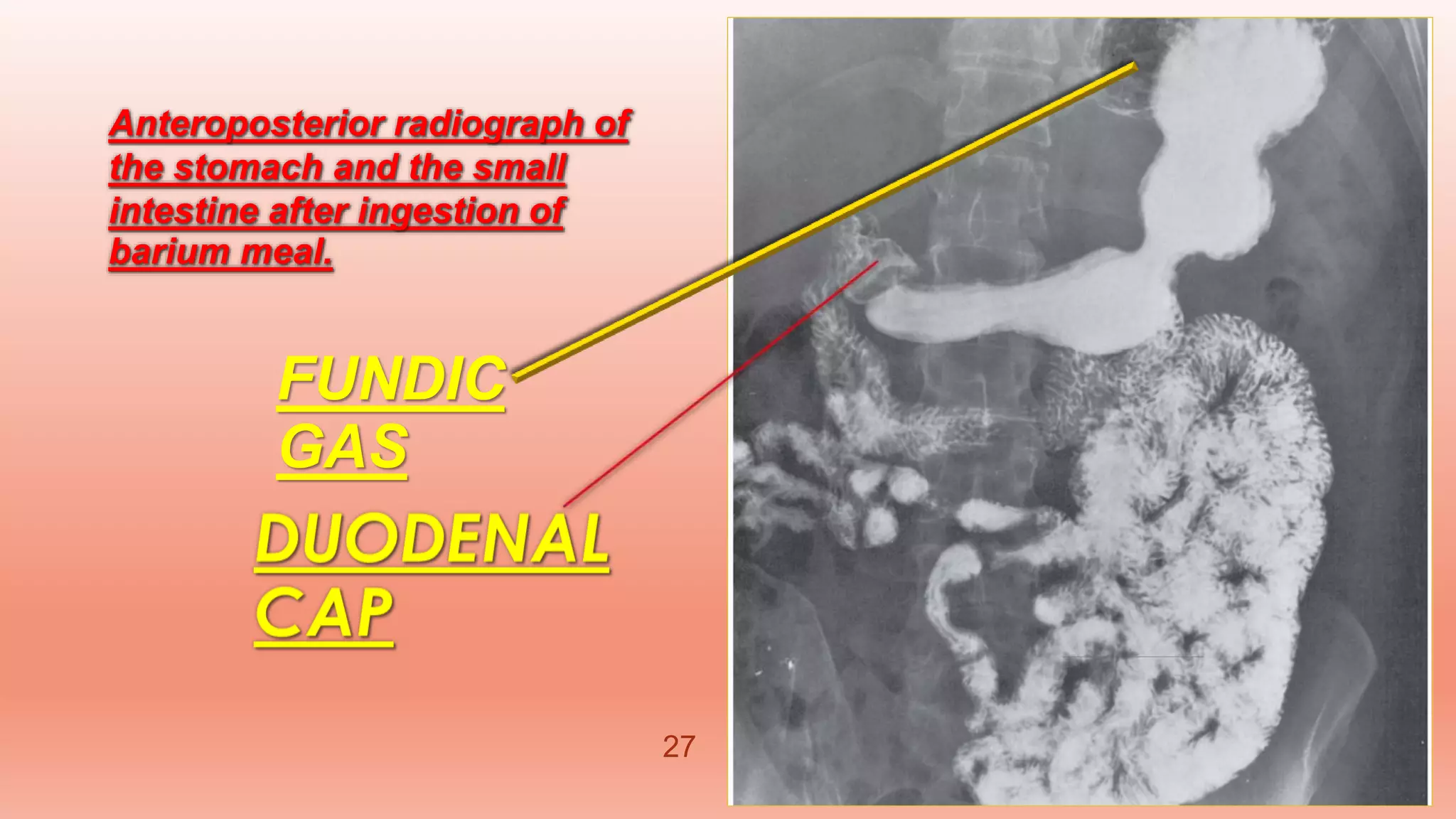 Radiographic anatomy | PPTX