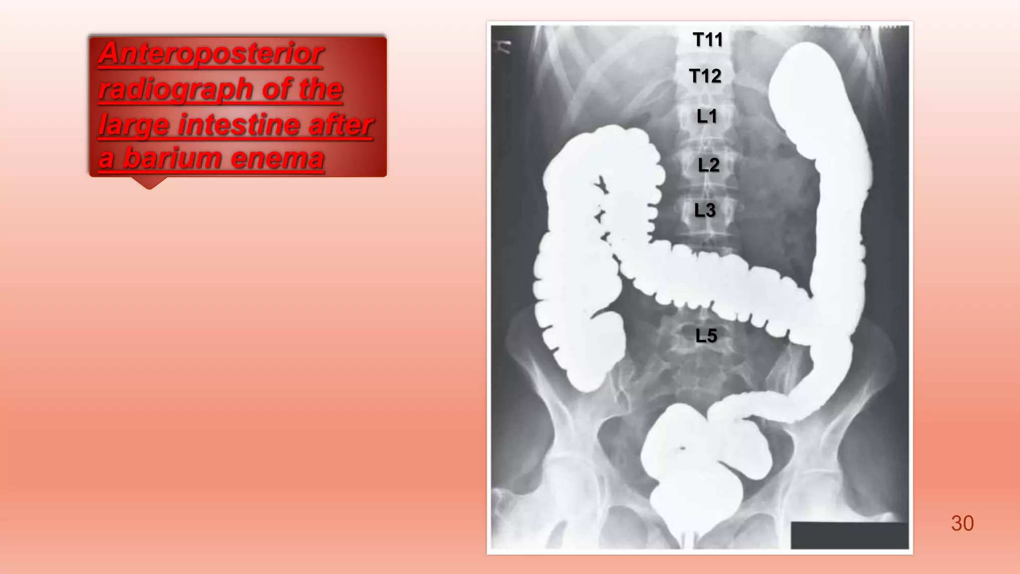 Radiographic anatomy | PPTX