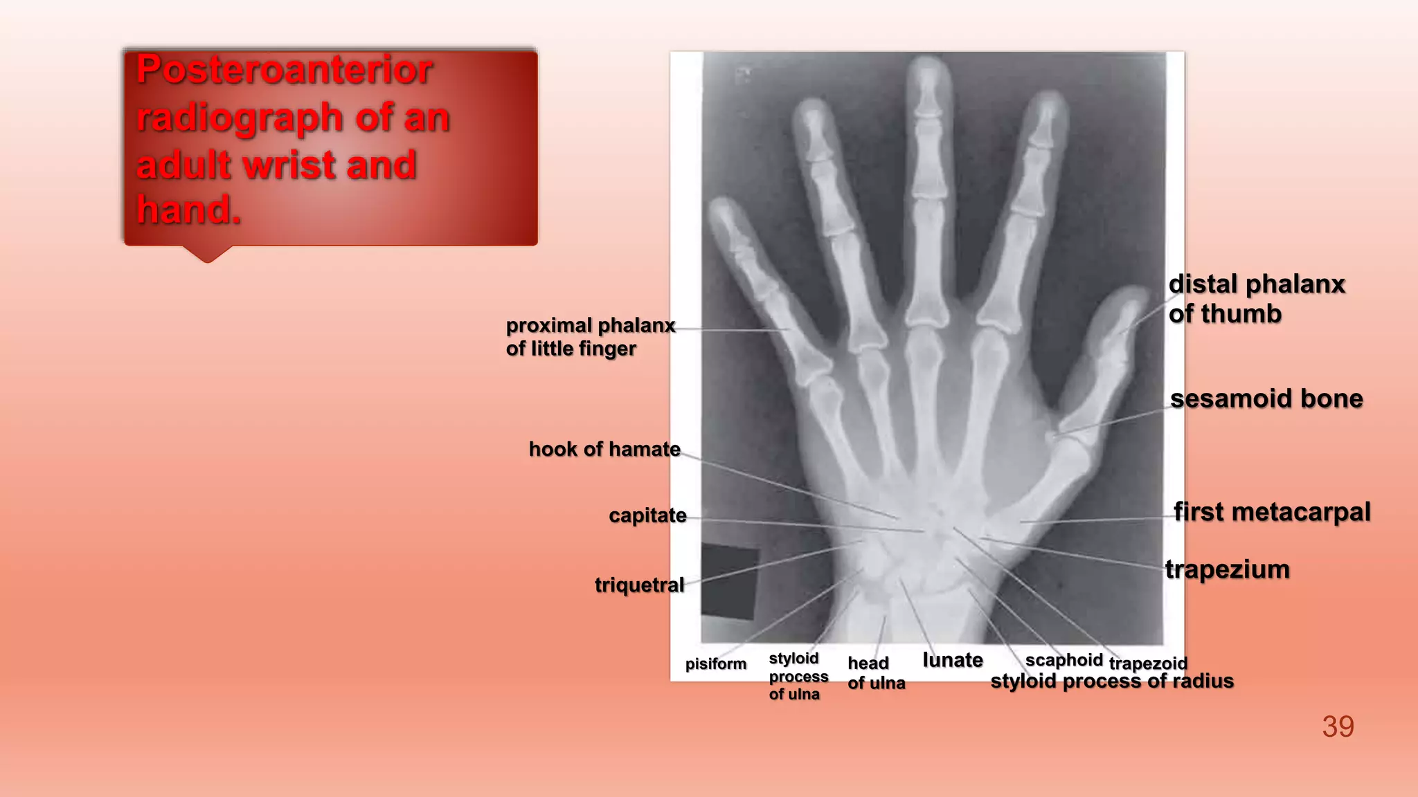 Radiographic anatomy | PPTX
