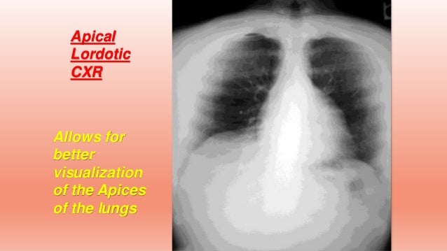 Radiographic anatomy